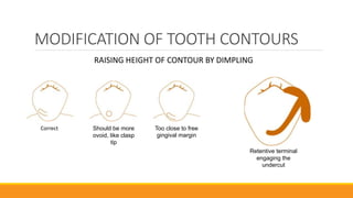 MOUTH PREPARATION IN CAST PARTIAL DENTURES | PPTX