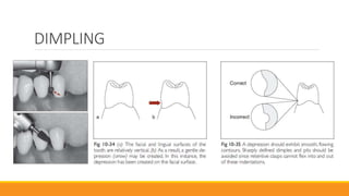 MOUTH PREPARATION IN CAST PARTIAL DENTURES | PPTX