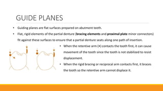 MOUTH PREPARATION IN CAST PARTIAL DENTURES | PPTX