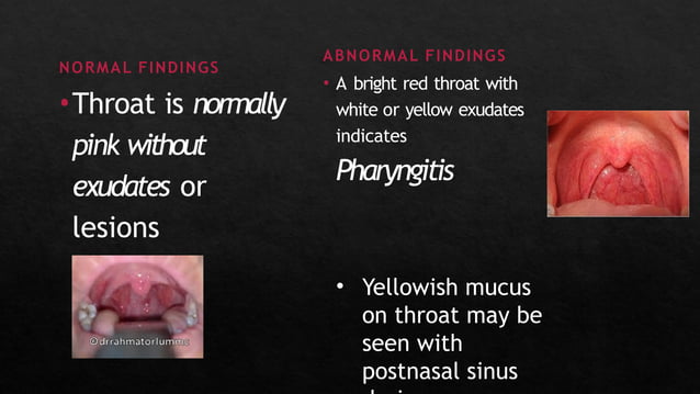 MOUTH,THROAT, NOSE, SINUS ASSESSMENT.pptx
