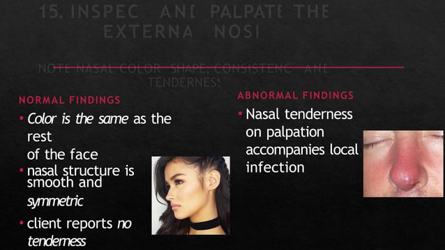MOUTH,THROAT, NOSE, SINUS ASSESSMENT.pptx