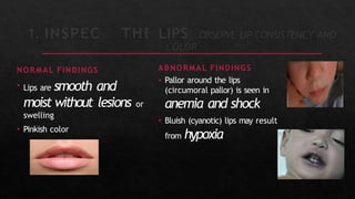 MOUTH,THROAT, NOSE, SINUS ASSESSMENT.pptx