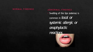 MOUTH,THROAT, NOSE, SINUS ASSESSMENT.pptx