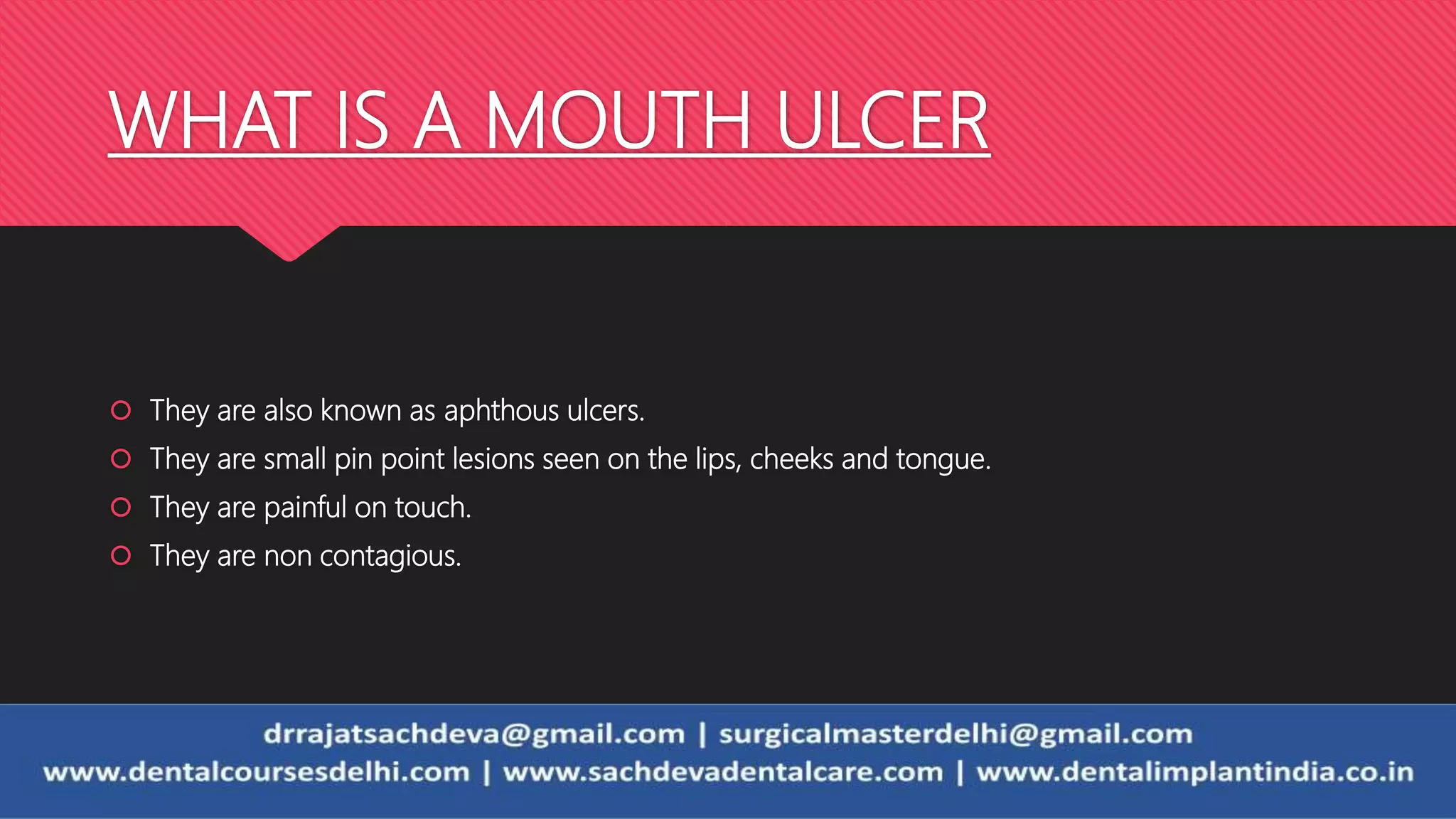 Mouth ulcers/canker sores | PPTX