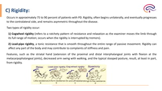 movement disorder for physiotherapy .pptx | Brain and Nervous System ...