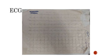 MOVEMENT DISORDER FULL chbg hypertension hyperglycemia.pptx