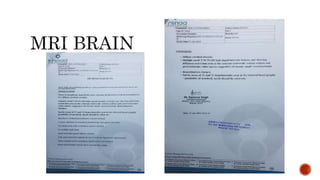 MOVEMENT DISORDER FULL chbg hypertension hyperglycemia.pptx