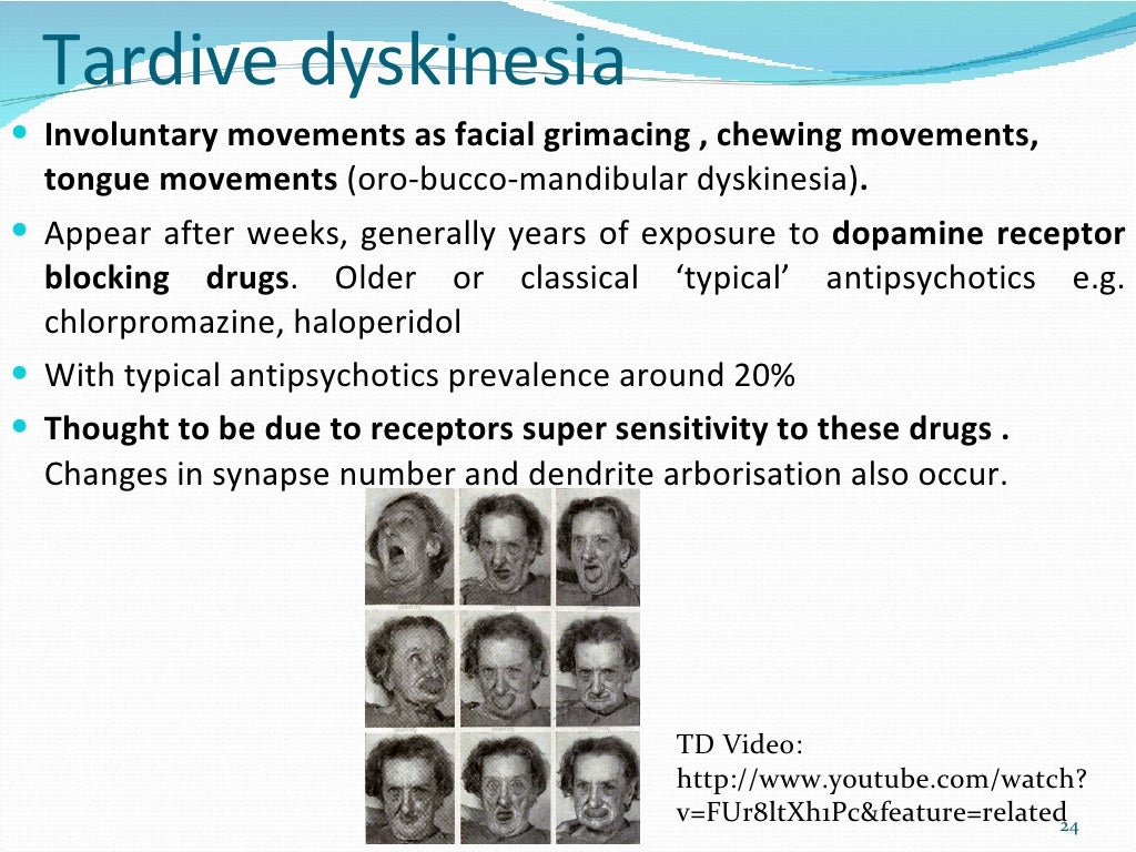 Movement disorders lecture