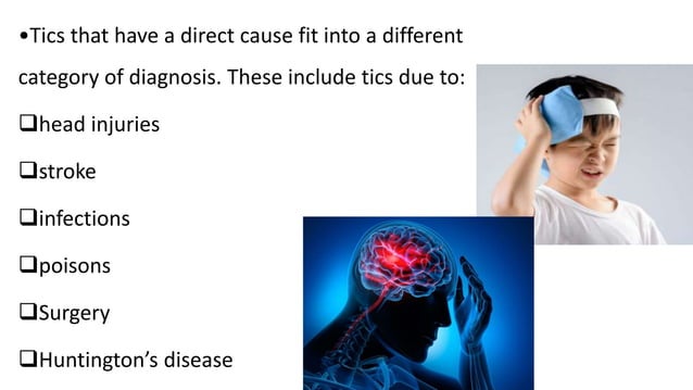 Movement disorders | PPTX