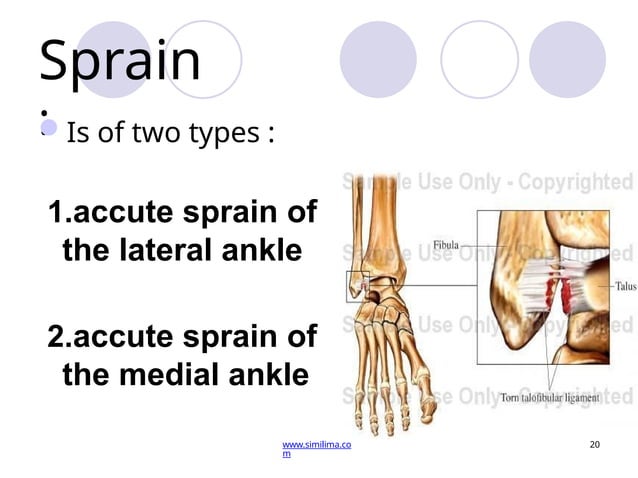 Details - of - movements-ankle-joint.pptx | Death, Injury, or Military ...