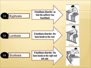 Grade 8 - Movement System | PPT