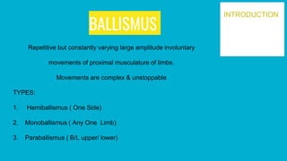 Movemet disorders | PPT