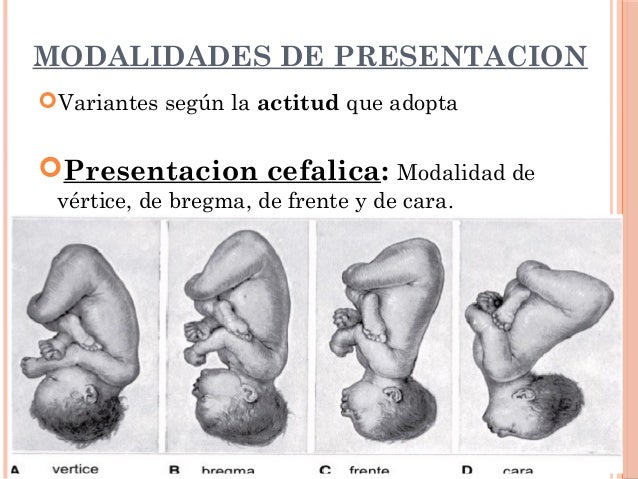 MOVIL FETAL. Stefania