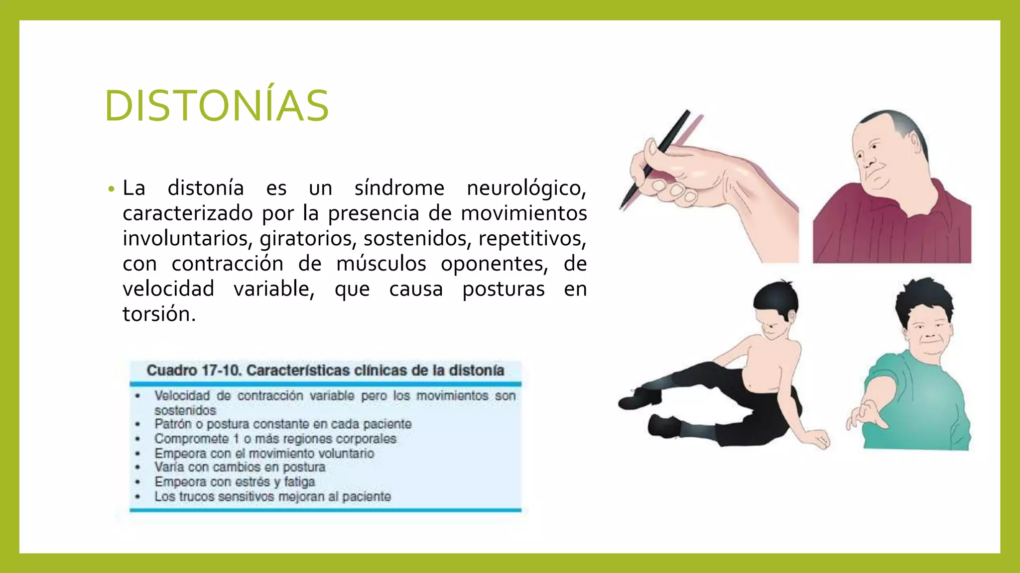 Movimientos Anormales: Coreas, Distonias Focales,Segmentarias y ...
