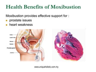 Moxibustion & Its Health Benefits | PDF
