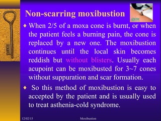 Moxibustion | PPT
