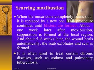 Moxibustion | PPT