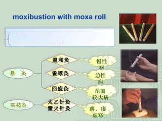 Moxibustion | PPT