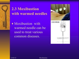 Moxibustion | PPT