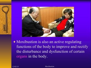 Moxibustion | PPT