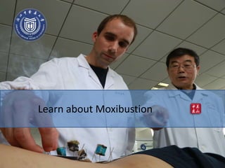 Moxibustion Therapy | PPT