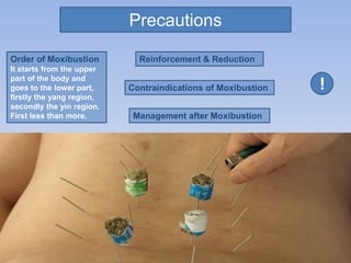 Moxibustion Therapy | PPT
