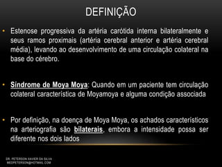 Moyamoya | PPTX