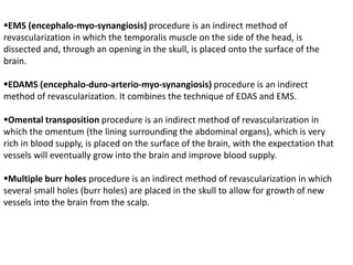 Moya moya disease | PPTX