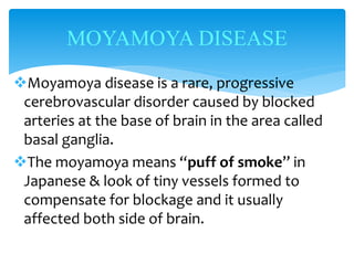 MOYAMOYA DISEASE.pptx