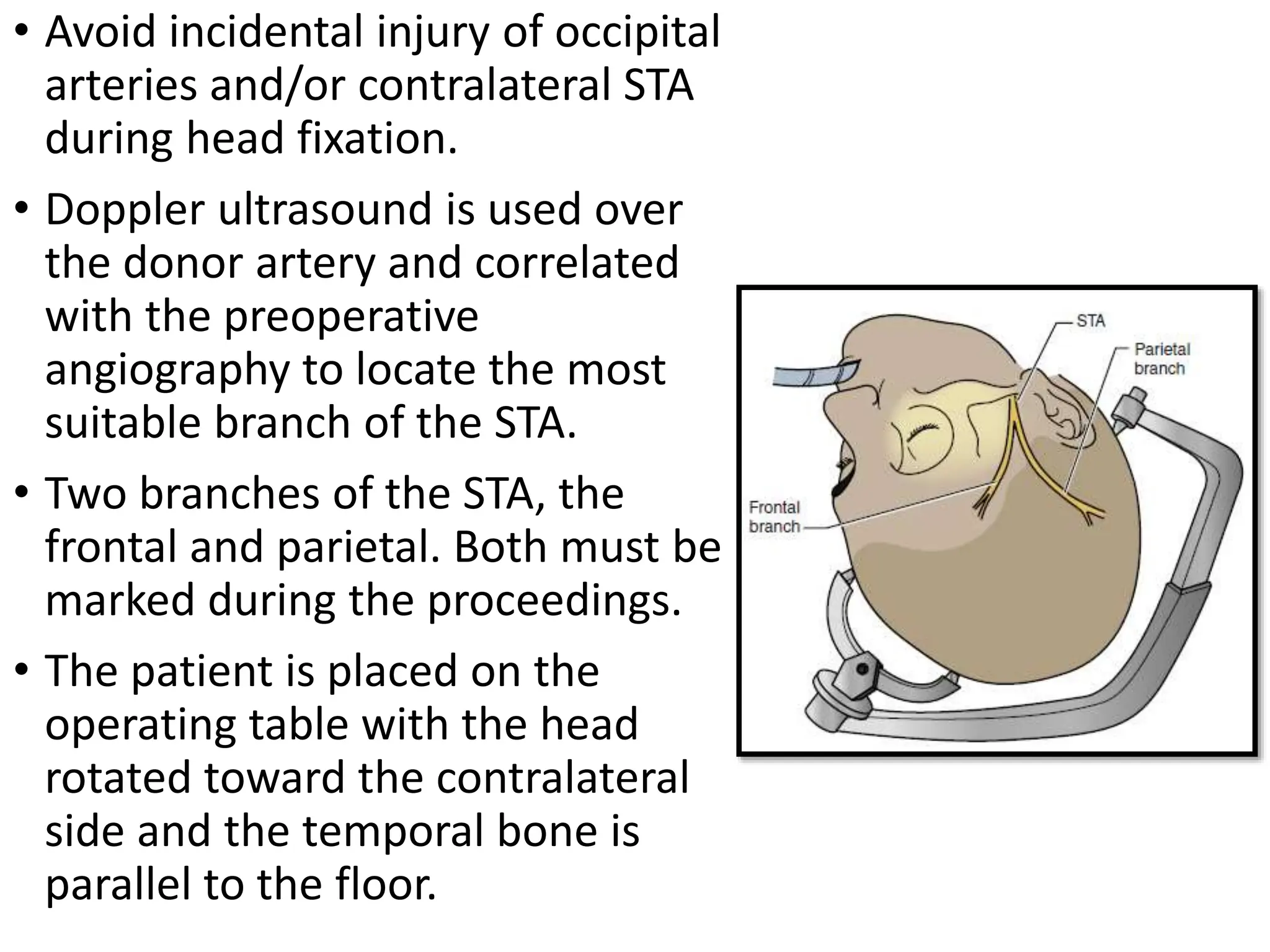 Moya Moya disease (vasculopathy/angiopathy) | PPTX