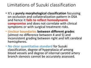 Moya Moya disease (vasculopathy/angiopathy) | PPT
