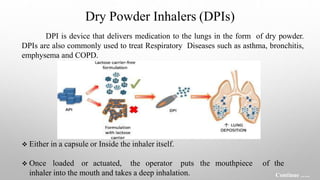 Ppt on dry powder inhalers | PPTX