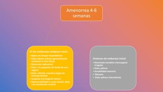 Embarazo Ectopico | PDF