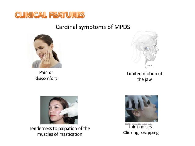 Mpds (Myofacial pain dysfunction syndrome) | PPTX | Physical Therapy ...