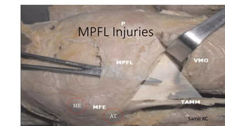 Medial patellofemoral ligament injuries and management | PPT