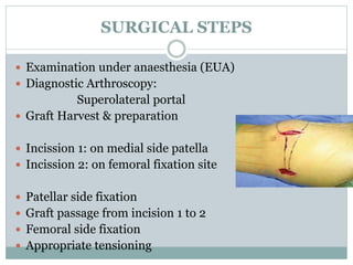 Medial Patellofemoral Ligament (MPFL) reconstruction 2014 | PPTX