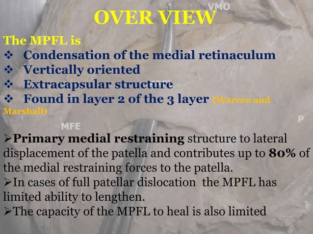 Medial Patellofemoral Ligament (MPFL) reconstruction 2014 | PPTX ...