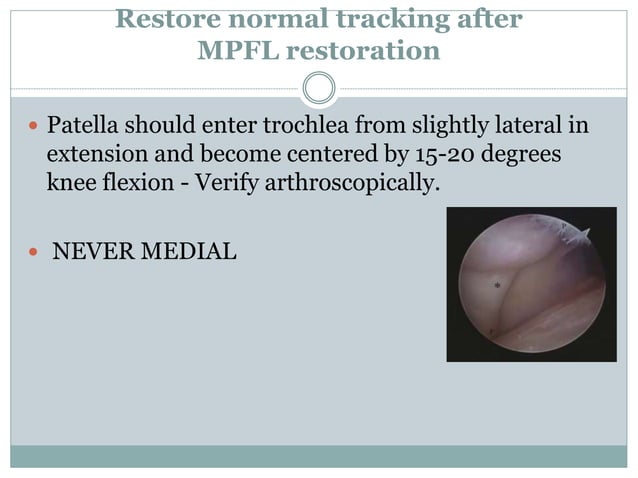 Medial Patellofemoral Ligament (MPFL) reconstruction 2014 | PPTX ...