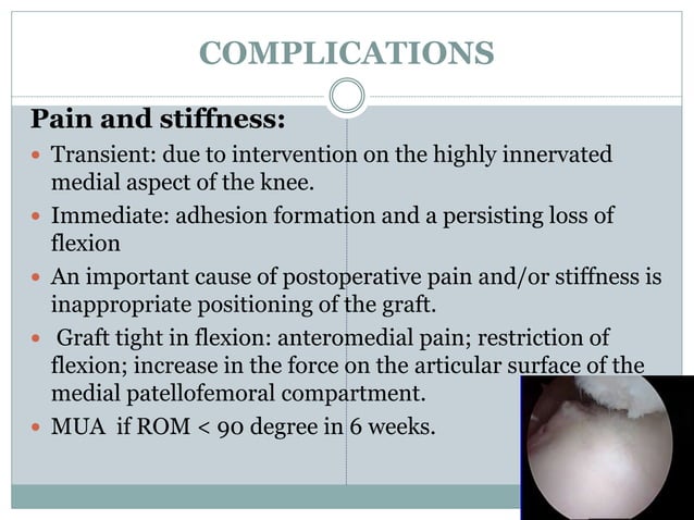 Medial Patellofemoral Ligament (MPFL) reconstruction 2014 | PPTX ...