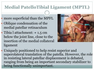 Medial Patellofemoral Ligament (MPFL) reconstruction 2014 | PPTX