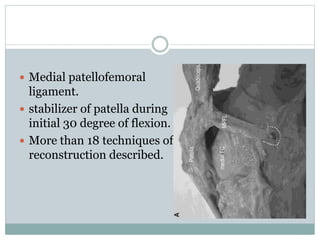 Medial patellofemoral ligament (MPFL) reconstruction | PPTX | Death ...