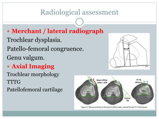 Medial patellofemoral ligament (MPFL) reconstruction | PPTX