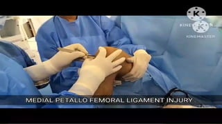 medial Patello femoral ligament (MPFL) Reconstruction | PPT