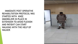 medial Patello femoral ligament (MPFL) Reconstruction | PPT