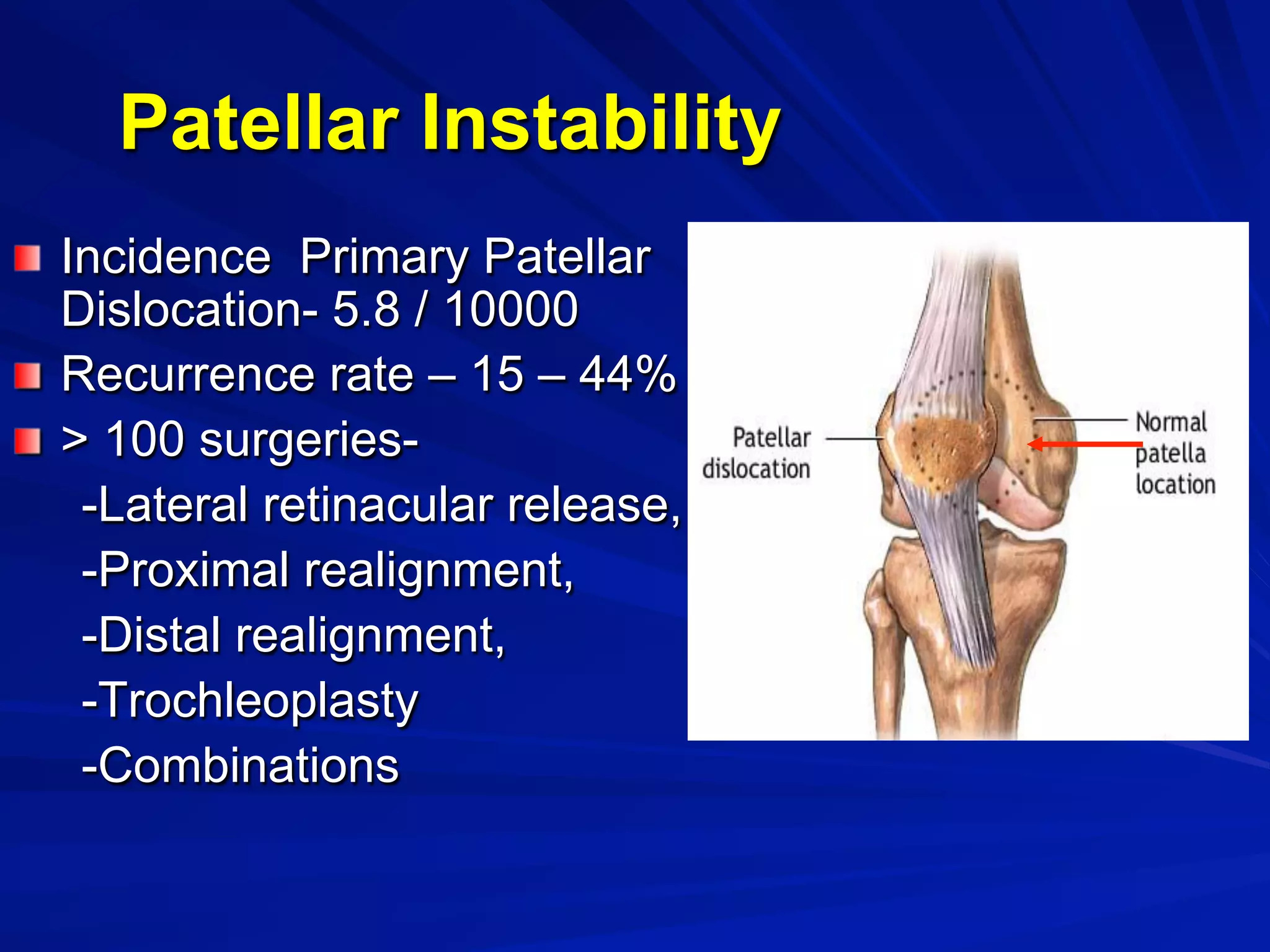 Mpfl tech - MPFL Reconstruction for Patellar Instability | PDF