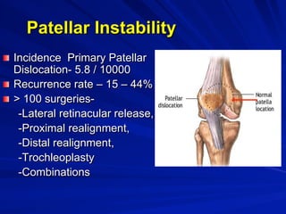 Mpfl tech - MPFL Reconstruction for Patellar Instability | PPT