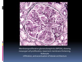 MPGN.pptx