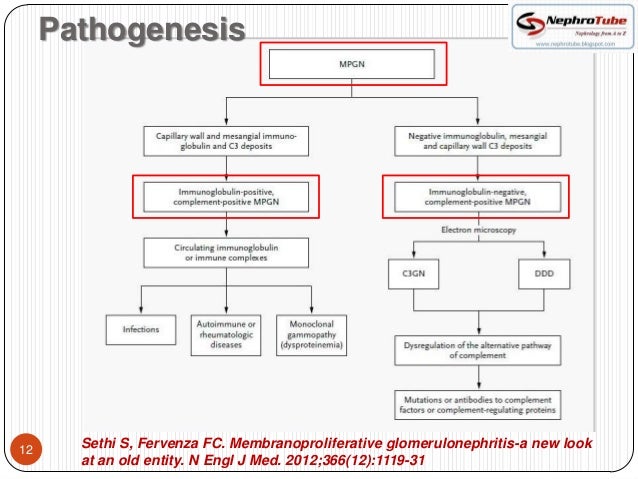 Membranoproliferative Glomerulonephritis - Diagnostic Road for Etiology ...