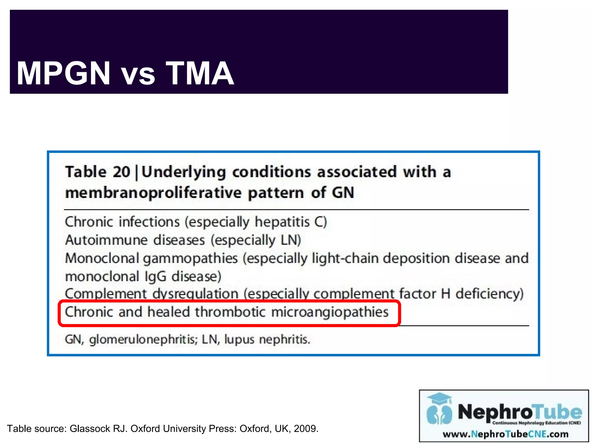 Membranoproliferative GN - Road to Diagnosis & Management - What is the ...