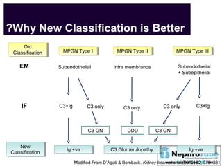 Membranoproliferative Glomerulonephritis Type 2